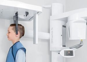 Cephalometric X-Ray – Dentaristo